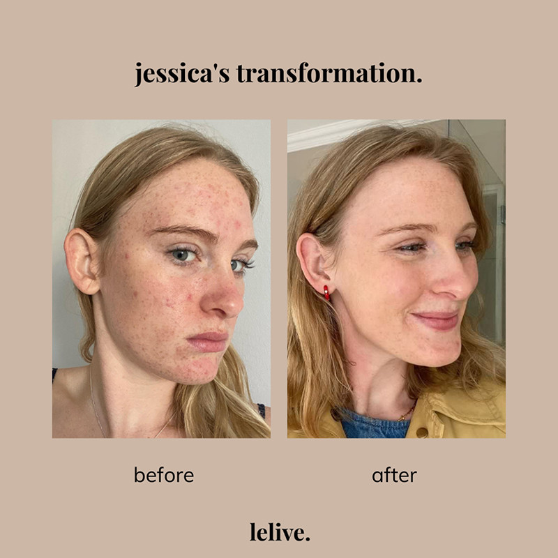 Buy Lelive. Bestselling 3 Step Routine - Brighten, Clarify + Glow All ...