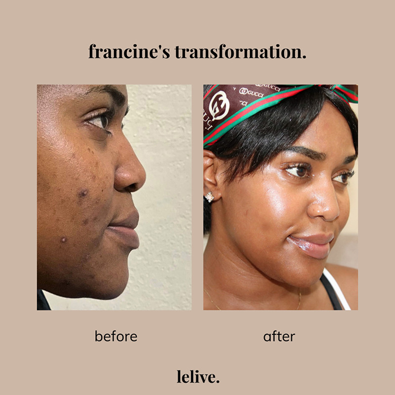 Buy Lelive. Bestselling 3 Step Routine - Brighten, Clarify + Glow All ...